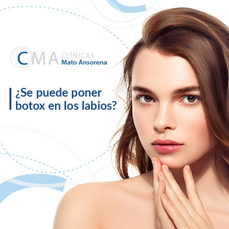¿Se puede aplicar el bótox en los labios? | Clínicas Mato Ansorena
