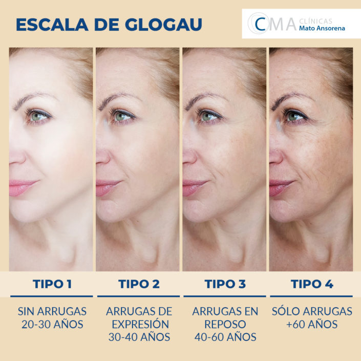 Envejecimiento activo: cómo afecta el paso del tiempo a nuestro rostro ...